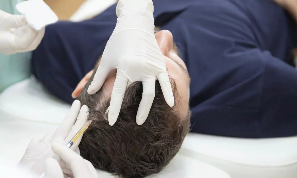 The Ultimate Guide To Hair Transplants Hair And Skin Science